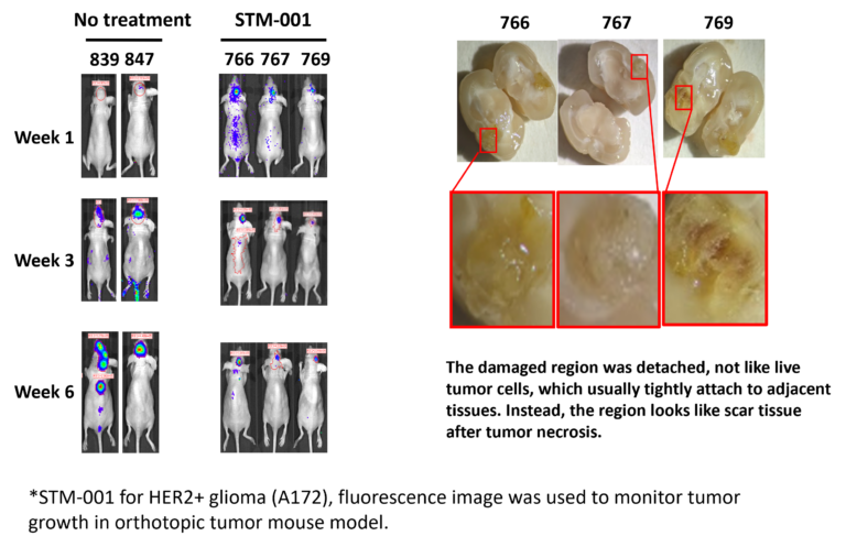 2401_Pipeline_Description_STM001 | SUNTEC MEDICAL